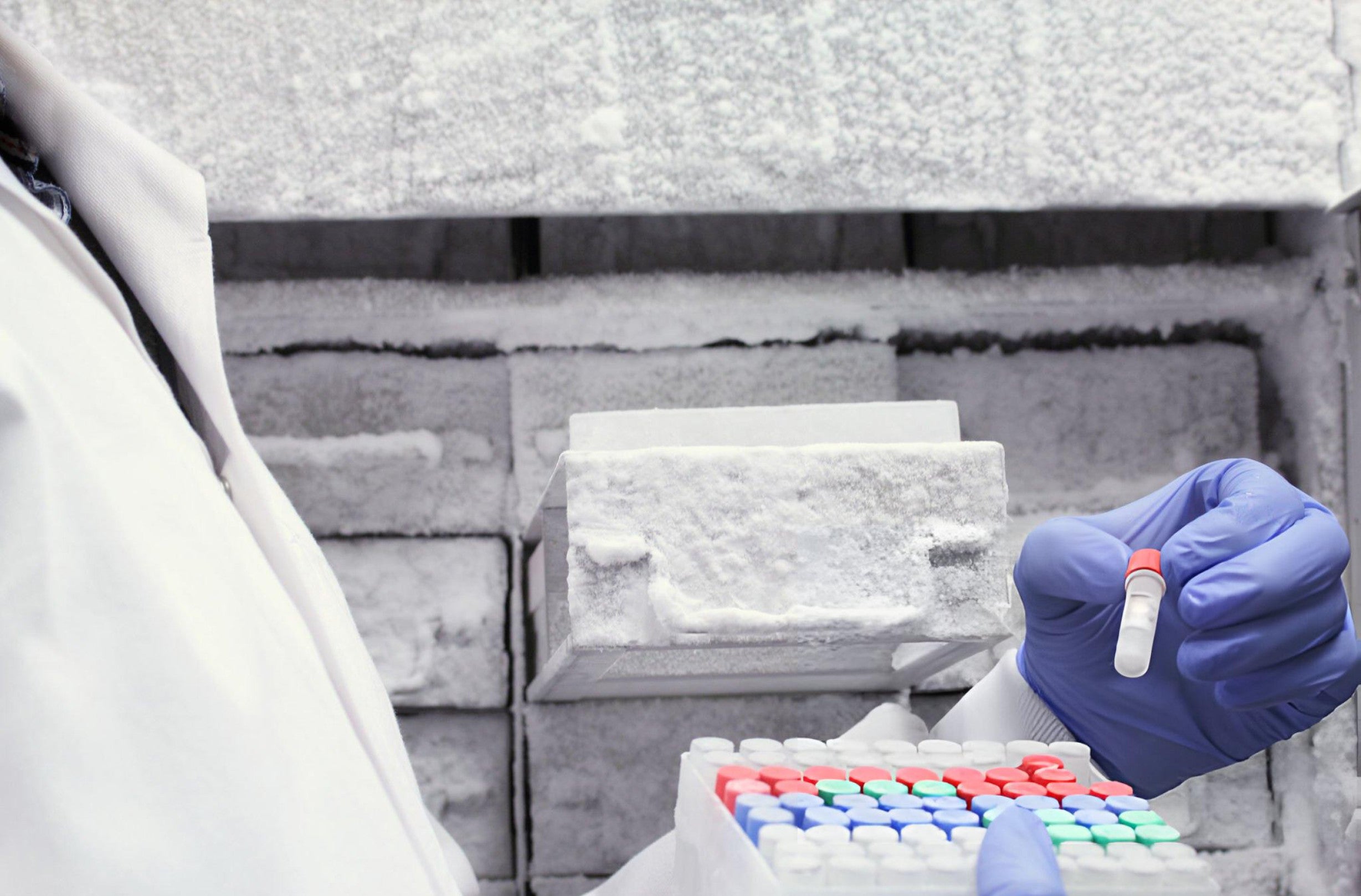 Preserving Sample Integrity with Ultra Low Temperature Biomedical Free ...