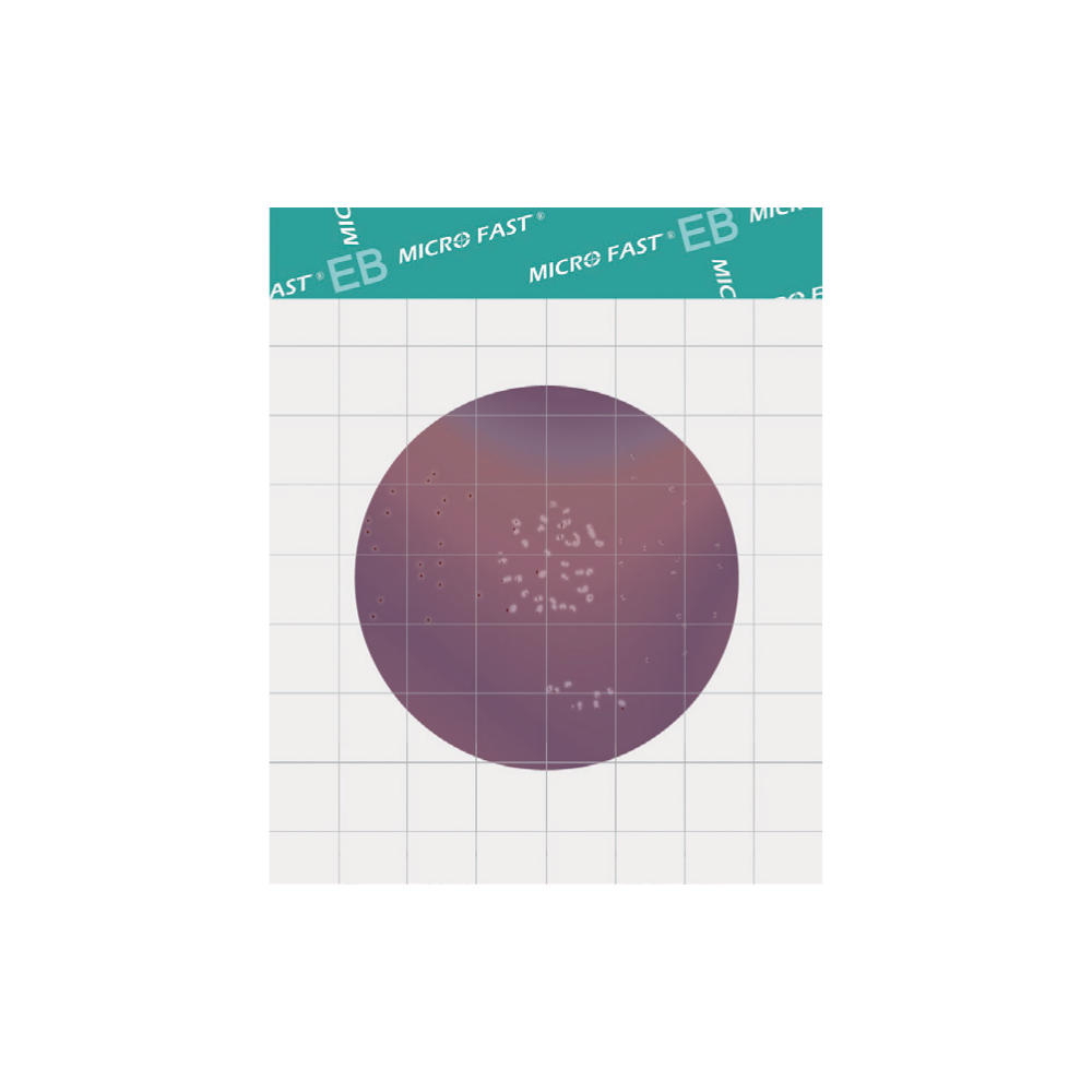 MicroFast® Enterobacteriaceae Count Plate | Rapid Detection in 24h – FC ...